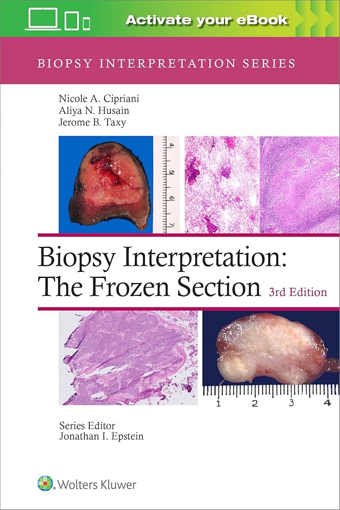 BIOPSY INTERPRETATION: THE FROZEN SECTION (HC) | ศูนย์หนังสือจุฬาฯ