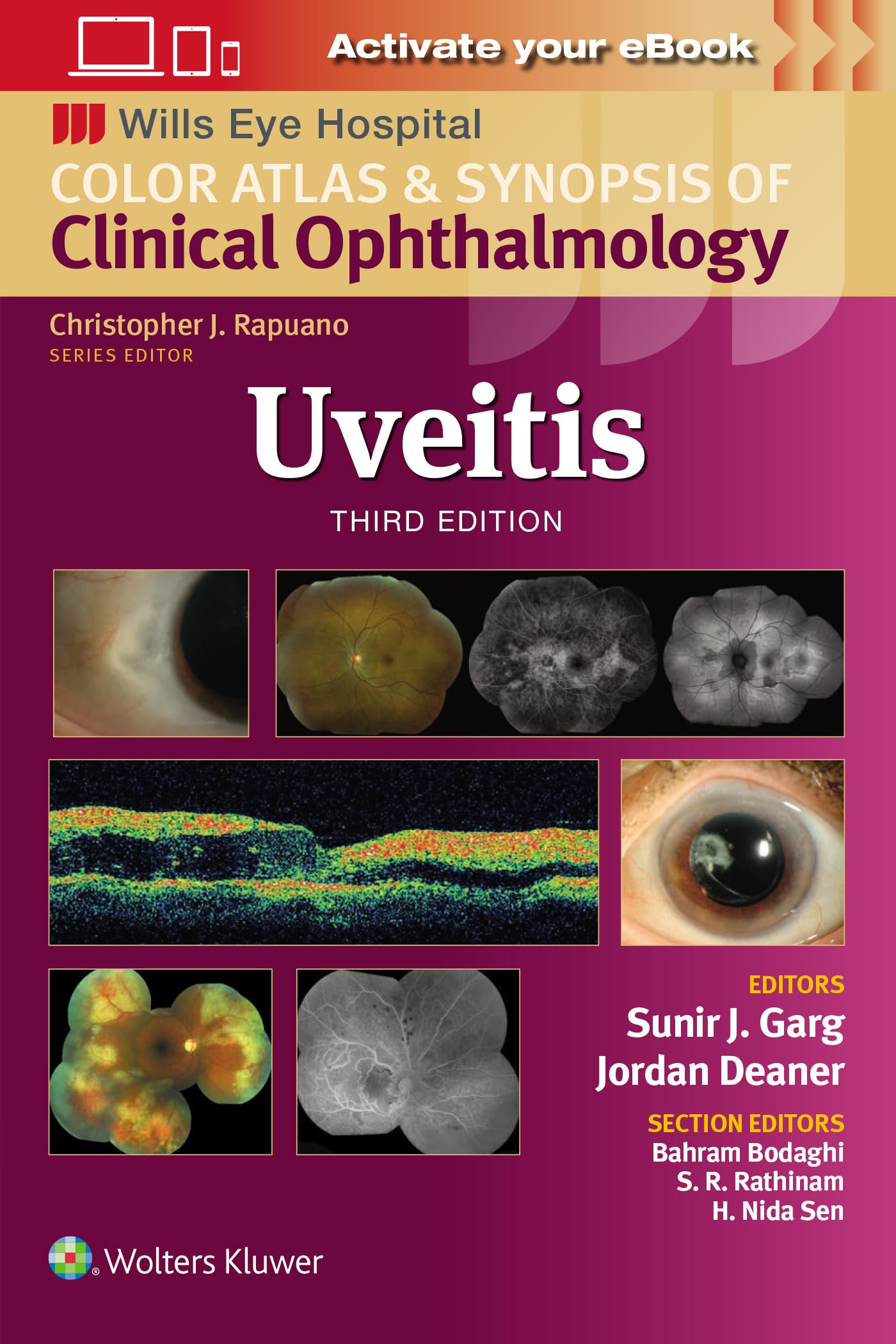 UVEITIS (COLOR ATLAS AND SYNOPSIS OF CLINICAL OPHTHALMOLOGY) | ศูนย์ ...