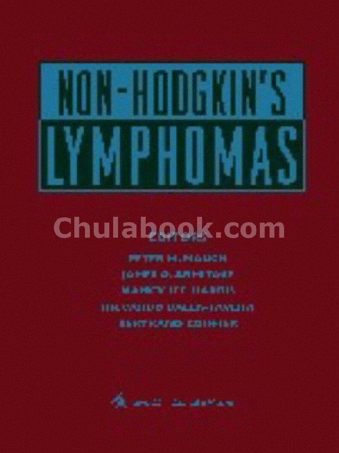 Nonhodgkin39s Lymphoma Shown Explained Using Medical Animation